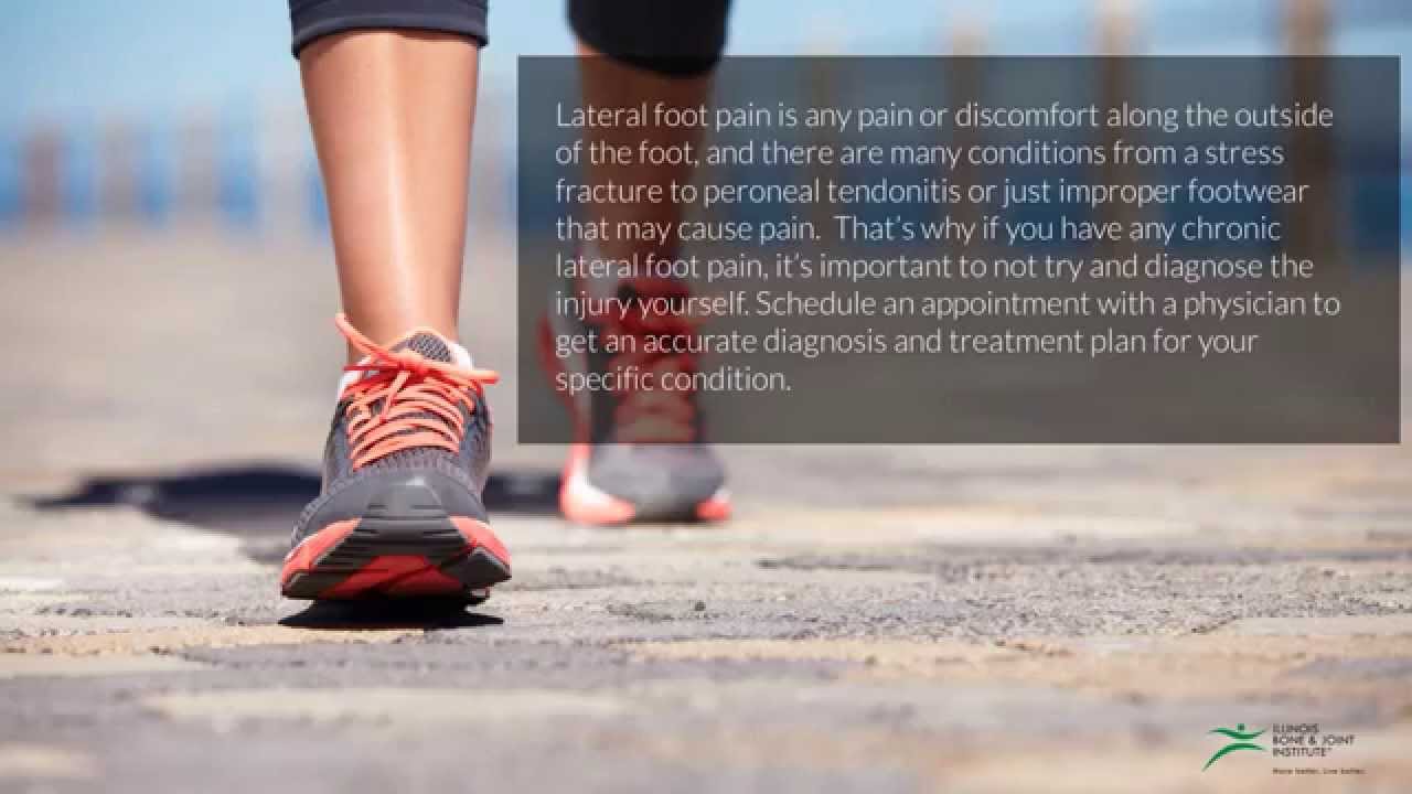 What is Lateral Foot Pain and what causes it? - YouTube
