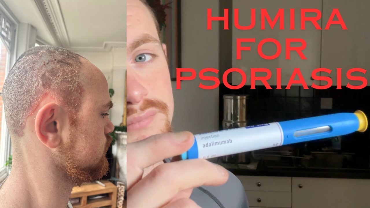 Humira for psoriasis - YouTube