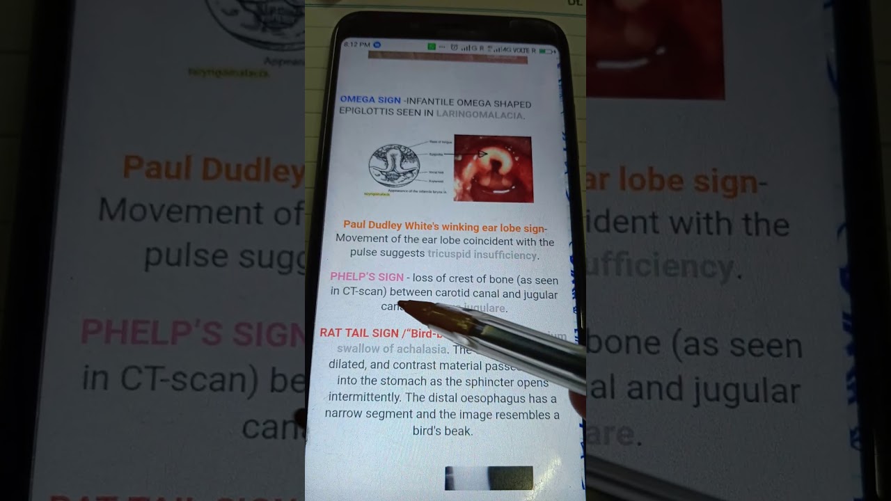 Phelps sign - YouTube