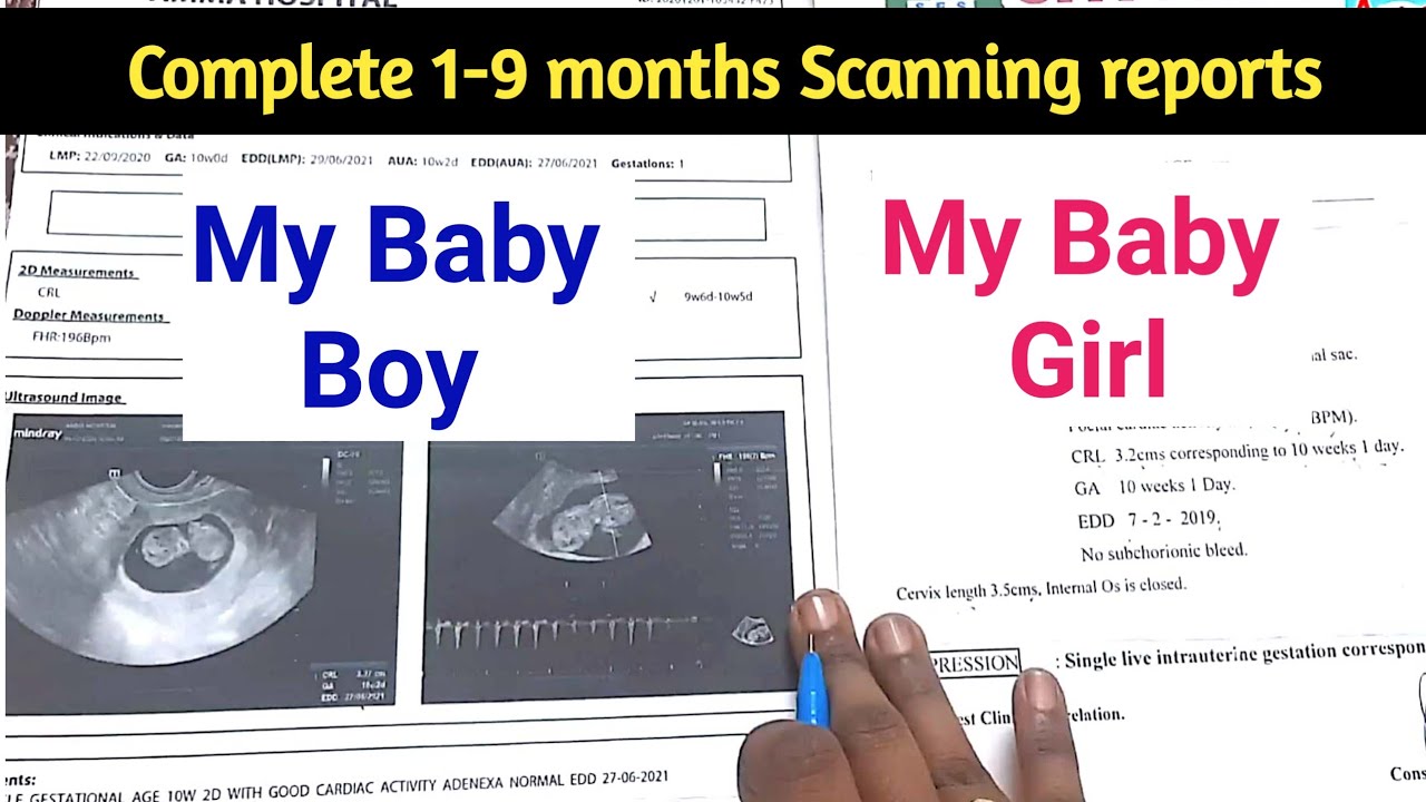 my Baby Boy,Girl complete scanning reports|baby Ultrasound|gender|heart ...