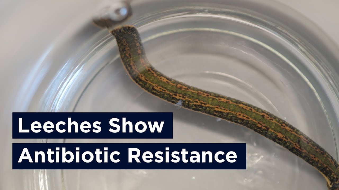Leeches Show That Even Tiny Levels of Antibiotics Cause Resistance ...