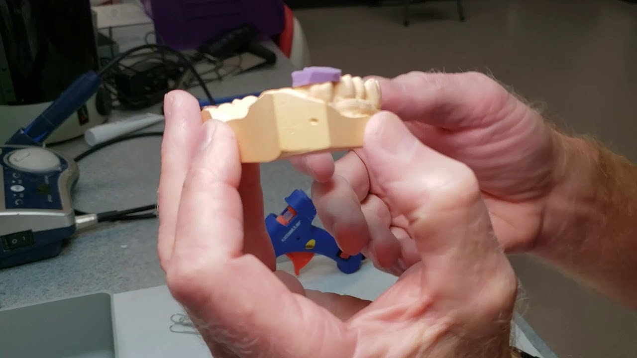 4. Mounting Diagnostic Models on a Panadent Articulator - Dr. Mark R ...