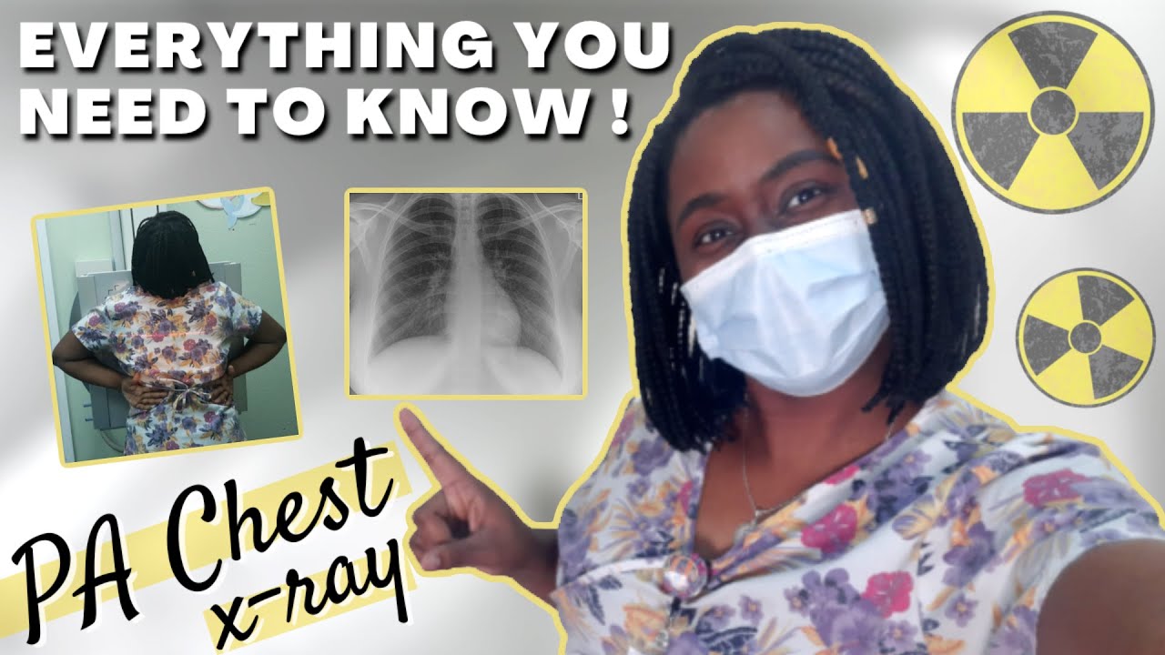how to: PA CHEST X-RAY ~ positioning, evaluation criteria & critiques ...
