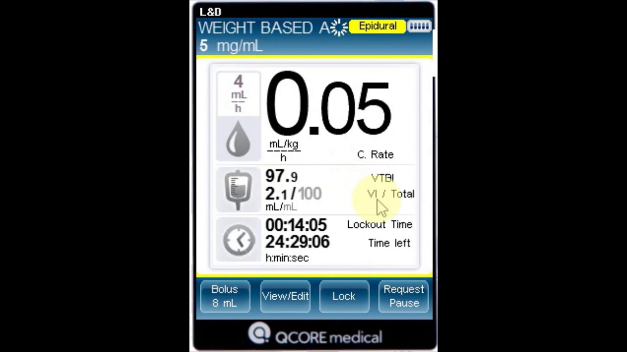 PCEA Running Screen Review Tutorial On The Sapphire Infusion Pump ...