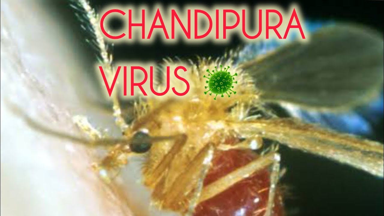 Chandipura virus 🦠 #drimranpatel #chandipuravirus #awareness - YouTube