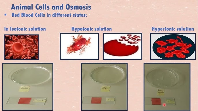 Osmosis In Animal Cells File:Anatomy And Physiology Of