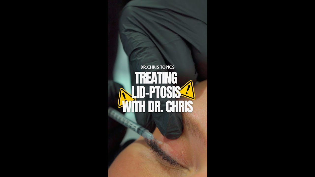 How To Treat a Eyelid-Ptosis After Botox Treatment | Botox ...