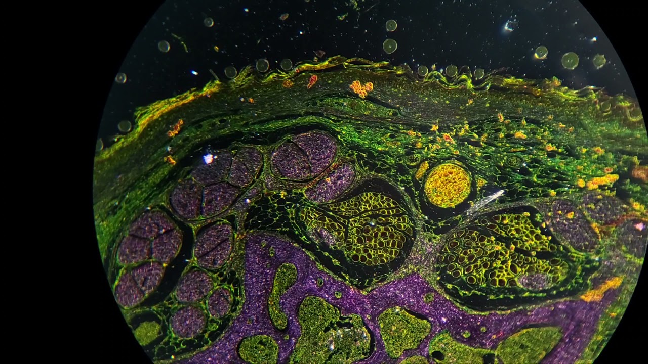 Cross section of rats tail 50x,100x,400x darkfield - YouTube