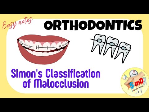 Simon's classification of Malocclusion- Orthodontics - BDS - YouTube