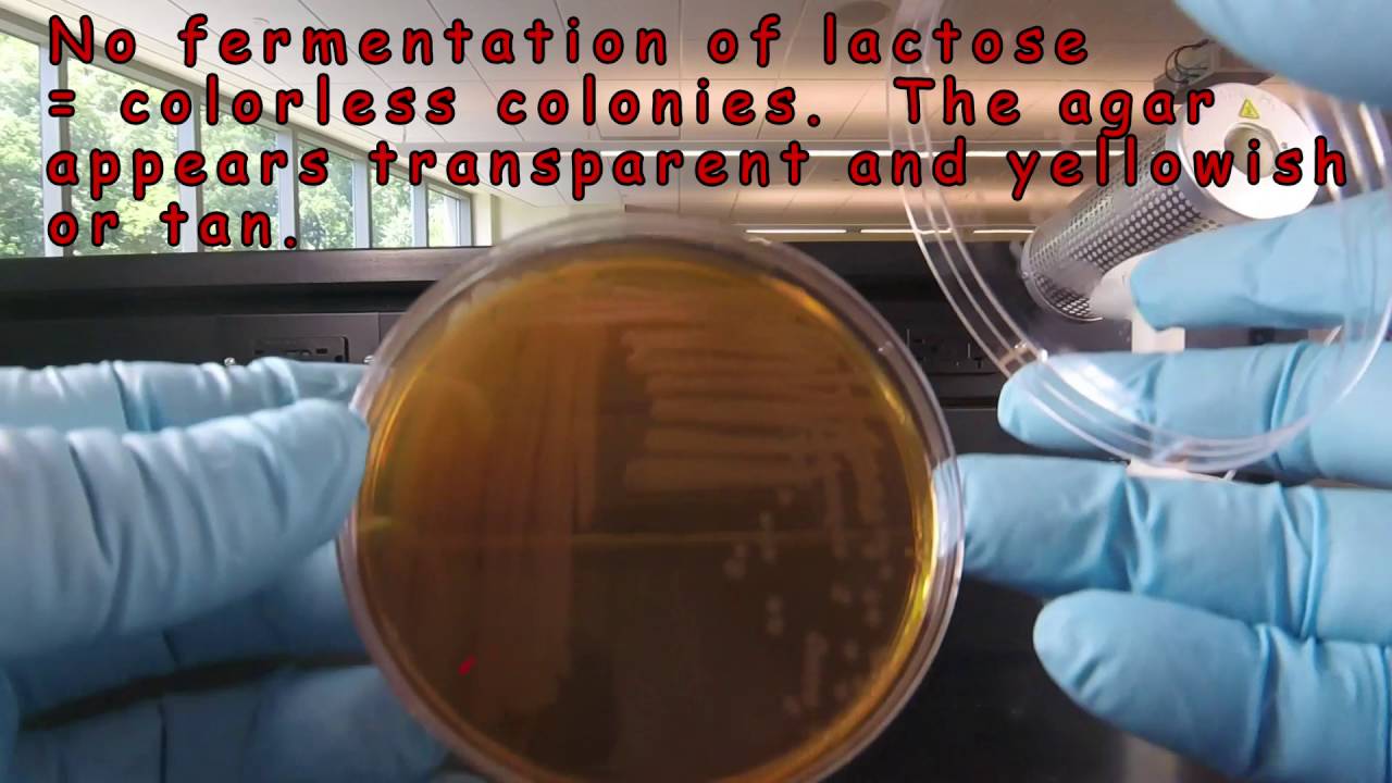 MacConkey Agar - YouTube