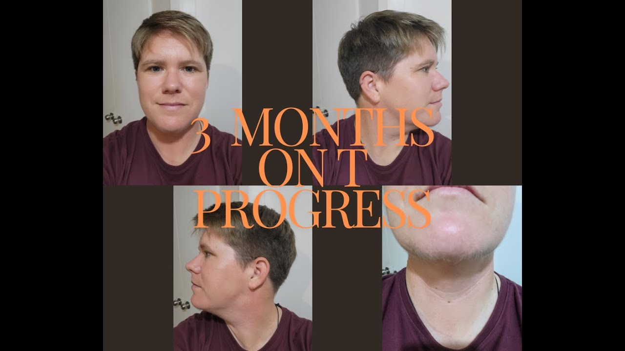 Voice and Facial Changes Progress - Day 0 to 3 Months - YouTube
