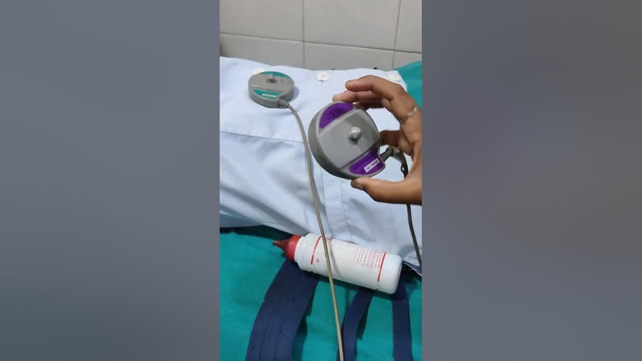 How to use CTG machine? - YouTube