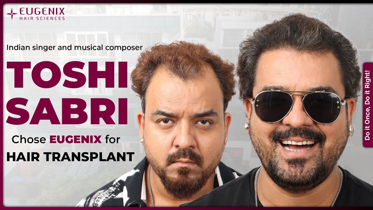 Toshi Sabri's Stunning Hair Transplant Journey at Eugenix Hair Sciences ...