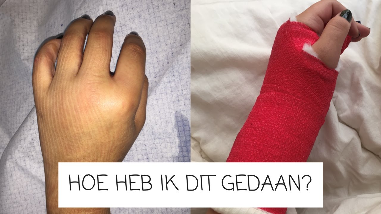 MIJN HAND GEBROKEN? - Samantha Tax - YouTube