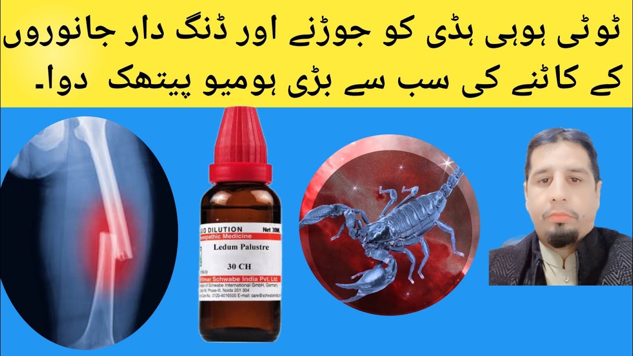 Golden Symptoms of LEDUM PAL 30/200 benefits and uses in hindi - YouTube