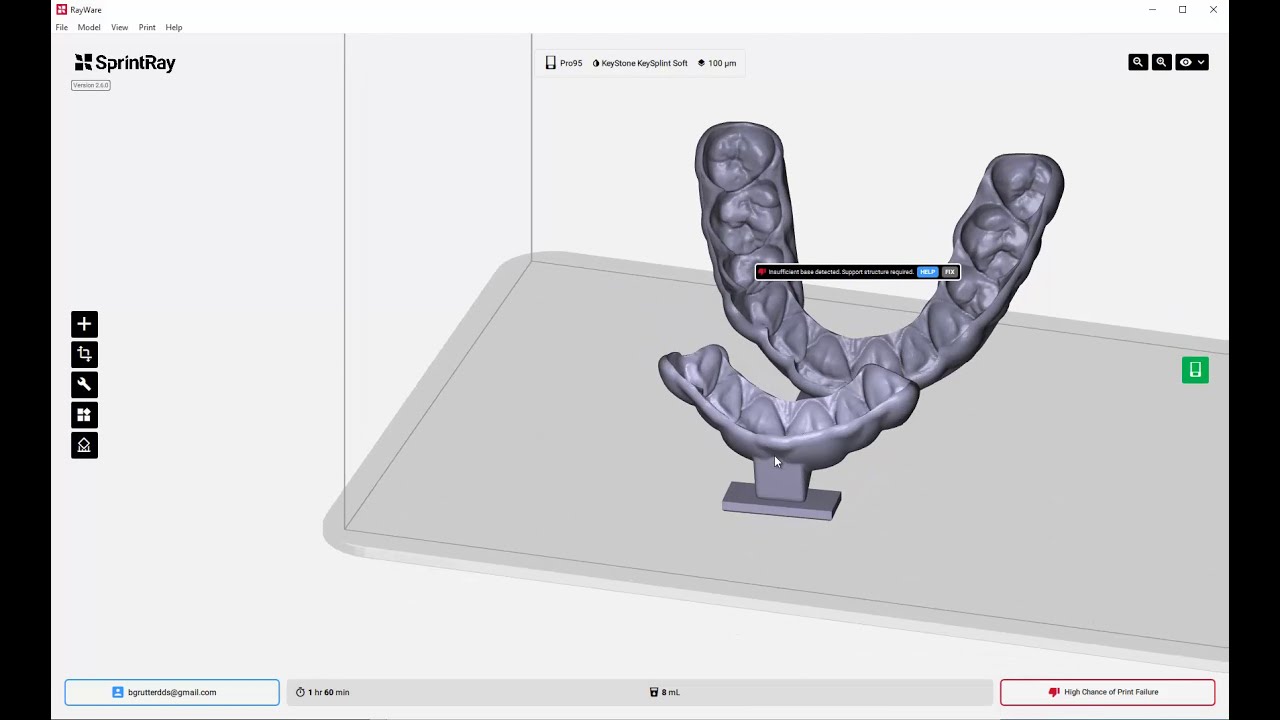 D3Splint WorkFlow: Anterior Deprogrammer - YouTube