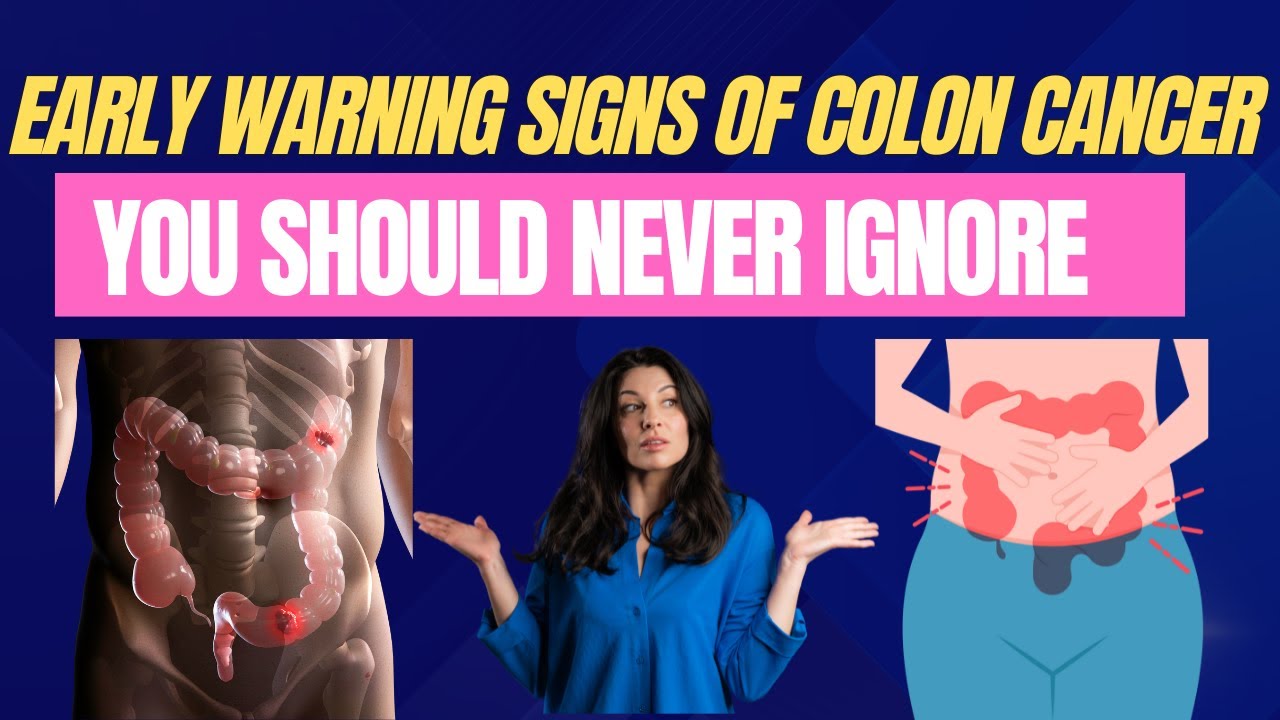 Early Warning Signs Of Colon Cancer You Should Never Ignore - YouTube
