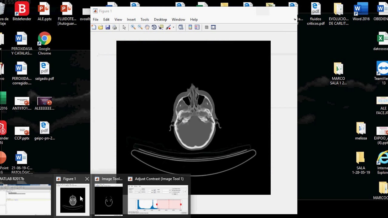 Imagenes DICOM+MATLAB Introduccion parte4 - YouTube