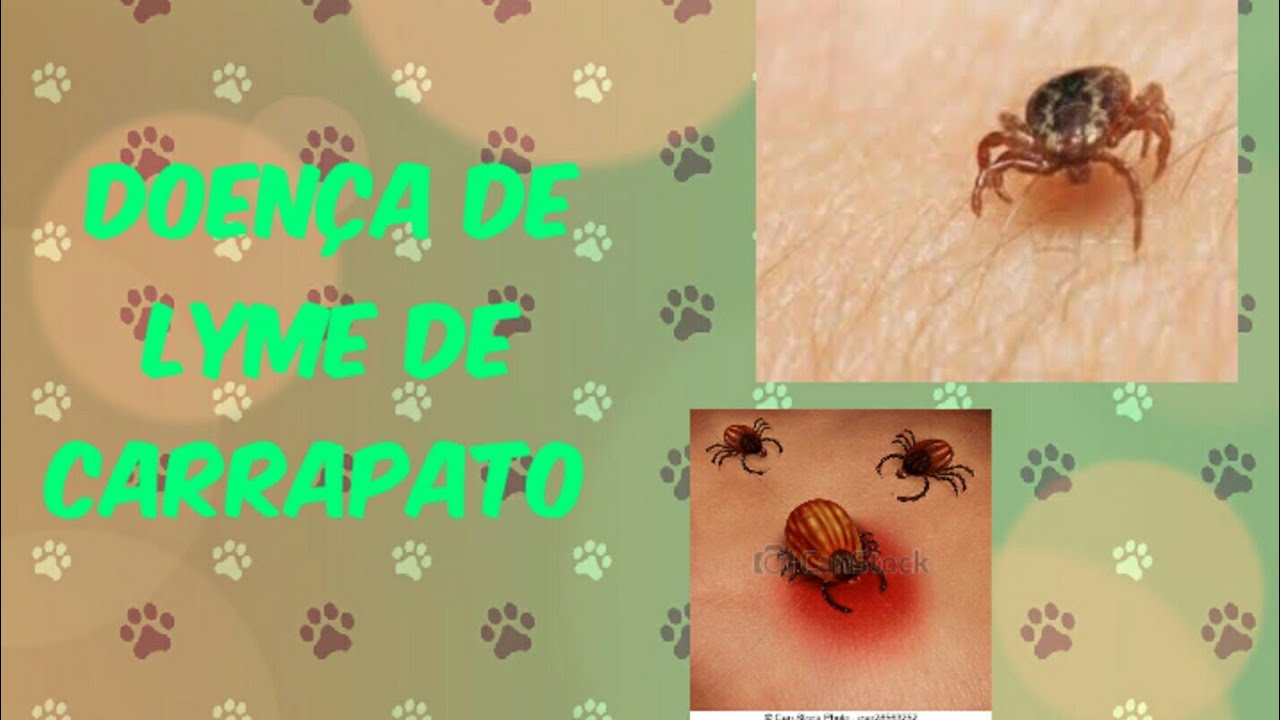 Doença de Lyme transmitida por carrapato - YouTube