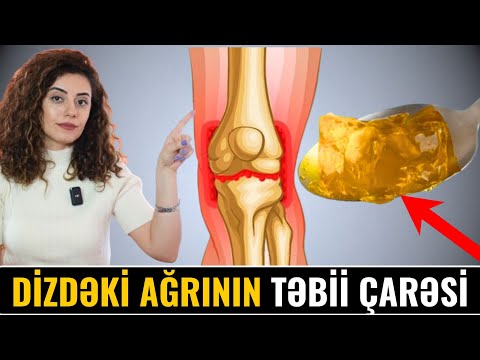 Çinlilər DİZ AĞRISININ Çarəsini Tapıb - Oynaqlarda Maye Azalıbsa, Bunu Edin!