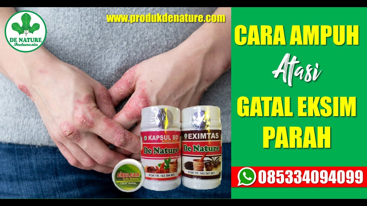 OBAT GATAL EKSIM EXIM MENAHUN SEMBUH TOTAL!! Harga Obat Gatal Eksim De ...