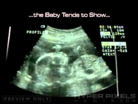 Pro-Life Video for Sanctity of Life Sunday | The Miracle of Life - YouTube