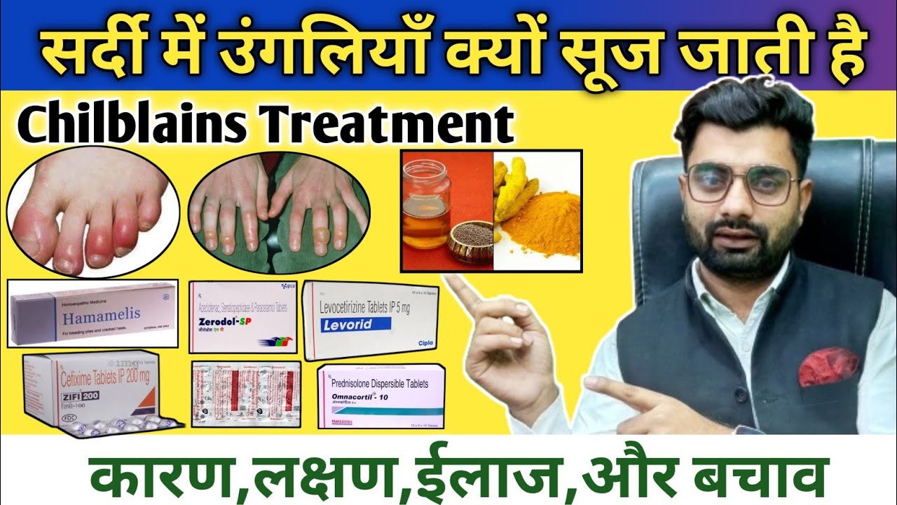 सर्दियों में पैरों की उंगलियों में सूजन कारण, लक्षण, इलाज| chilblains ...