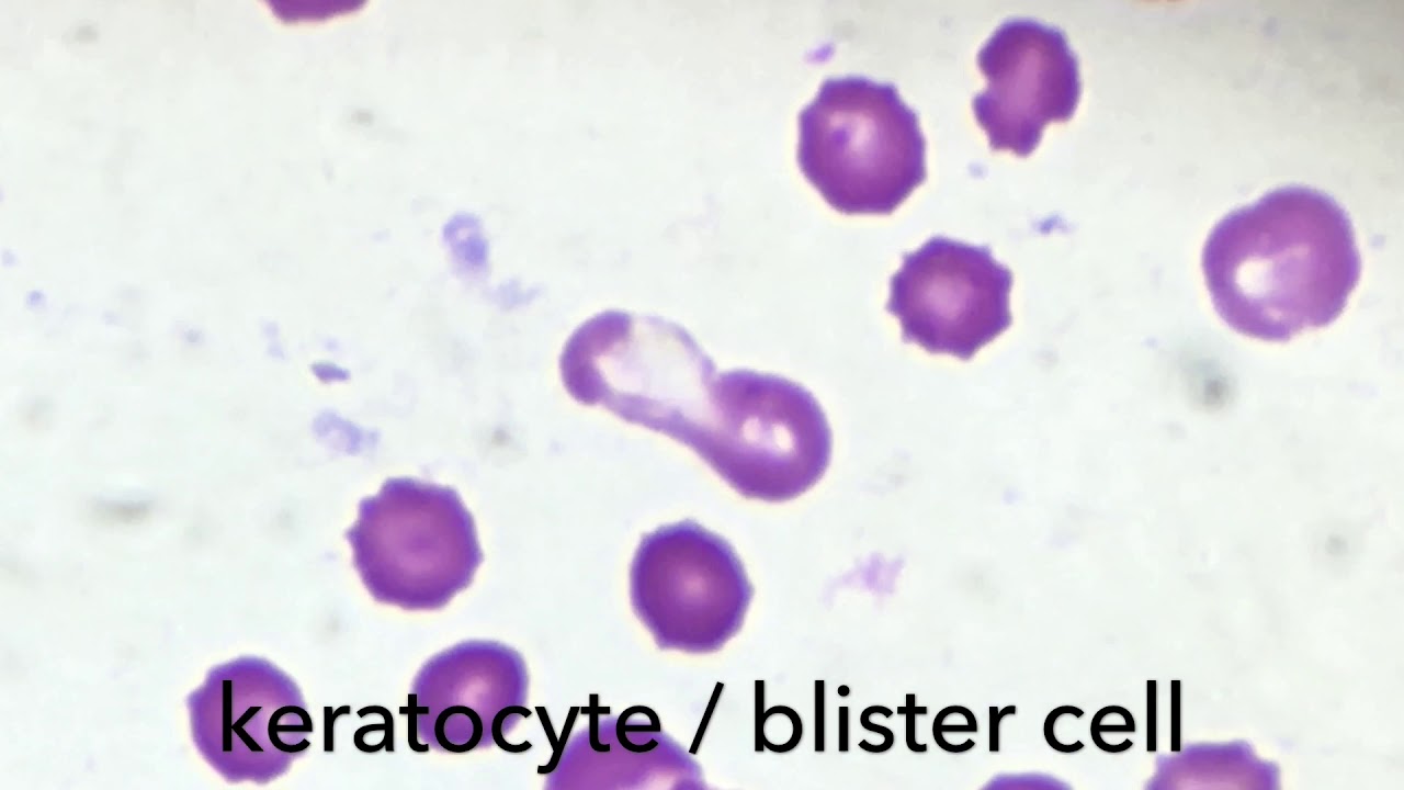 Blister Cells