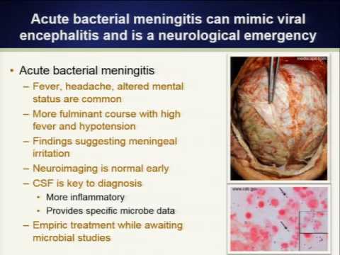 clinical approach to encephalitis - YouTube