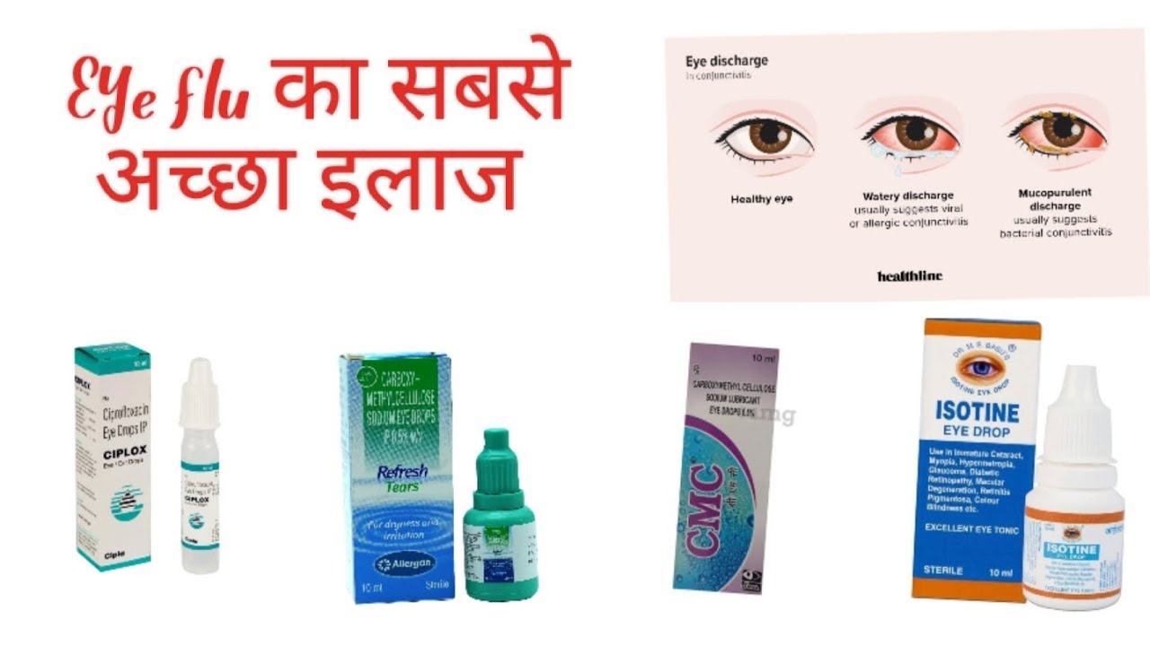 Best treatment for EYE FLU // 3 din m thik kare eye flu - YouTube