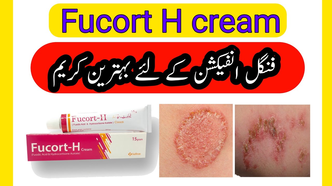 fucort h cream fungal infection k liya zakham k liya - YouTube