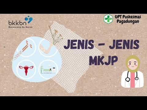 Jenis - Jenis Metode Kontrasepsi Jangka Panjang (MKJP) - YouTube