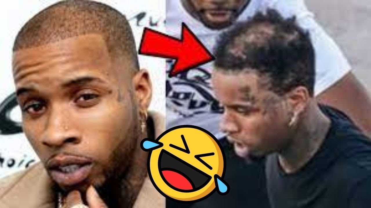 TORY LANEZ CLAIMS HIS BALD SPOT IS CAUSED BY ALOPECIA - YouTube