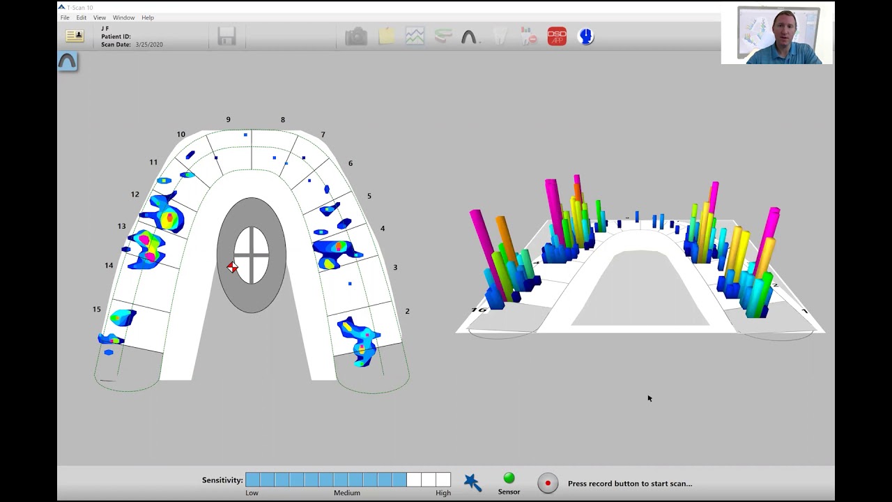 How to Set T-Scan Sensitivity and Record Patient Data - YouTube