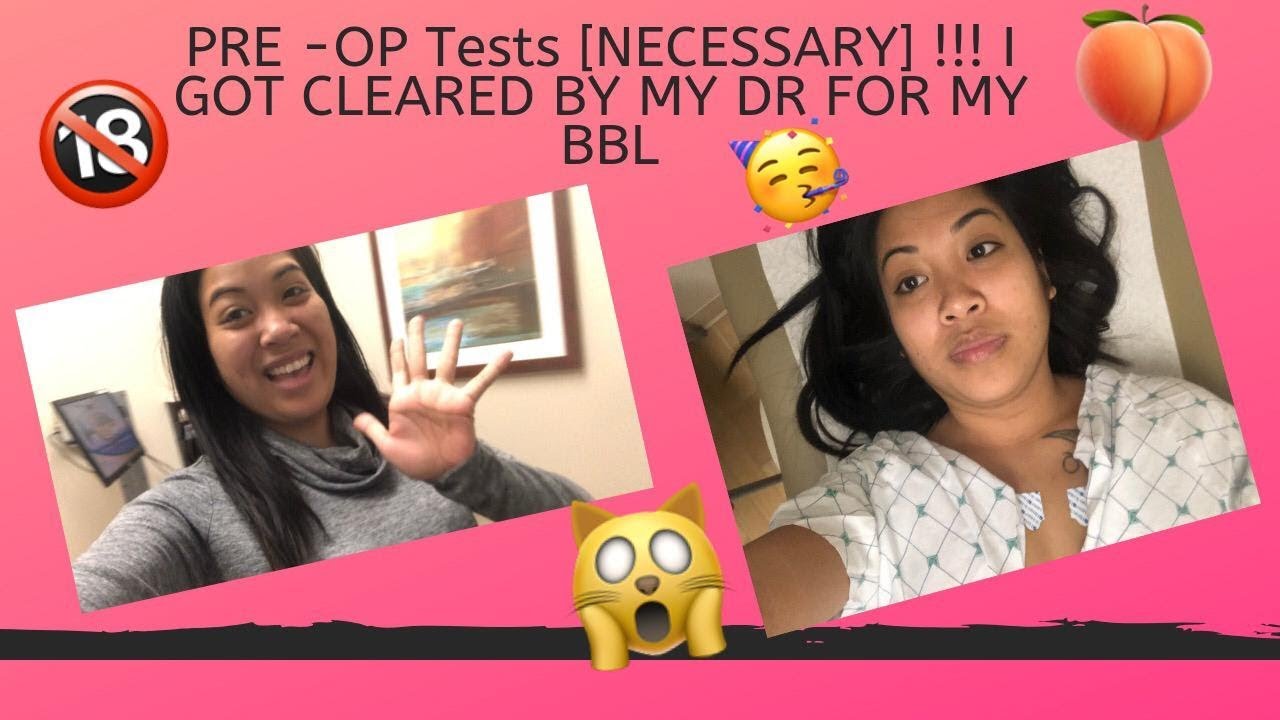 EVERYTHING YOU NEED TO KNOW BEFORE GETTING A BBL/360 - YouTube