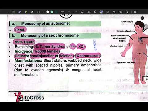 Birth defects | general embryology - YouTube