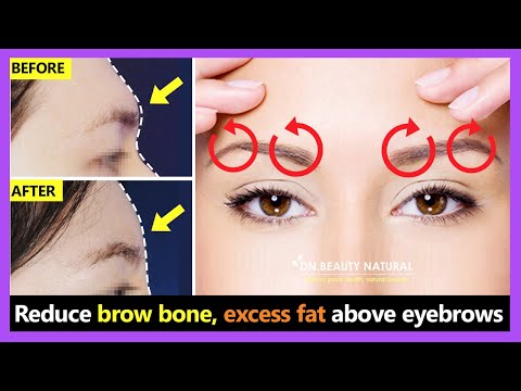 How to reduce Brow bone naturally and remove excess fat above the eyebrows with Exercise & Massage