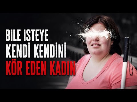 BİLE İSTEYE KENDİ KENDİNİ KÖR EDEN KADIN: Jewel Shuping