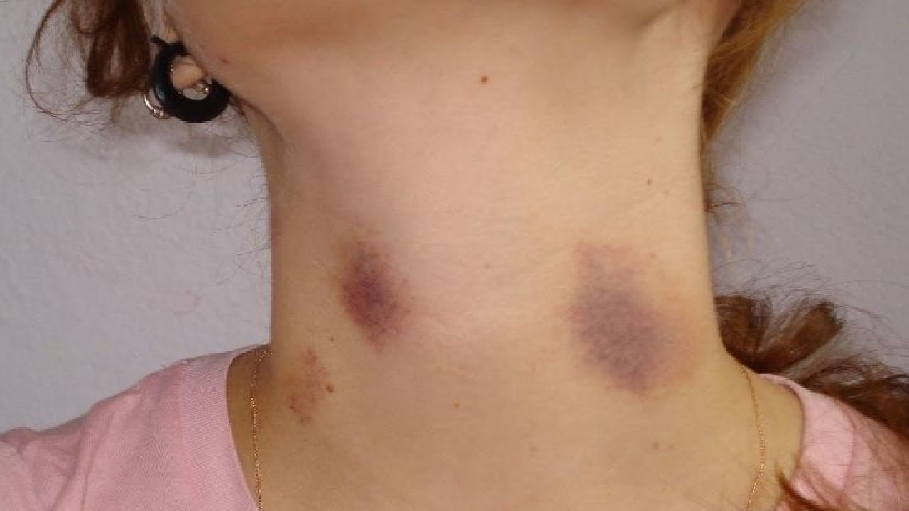 how to get a fake hickey on your neck - fake hickey tips - YouTube