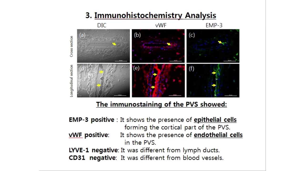 Primo Vascular System (PVS) in Lymph Ducts - YouTube