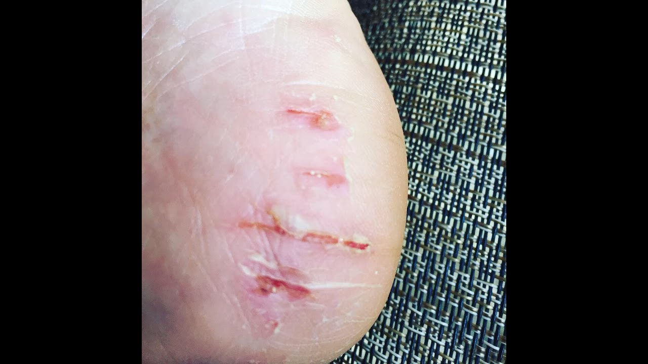 How to prevent swim fin cuts - YouTube