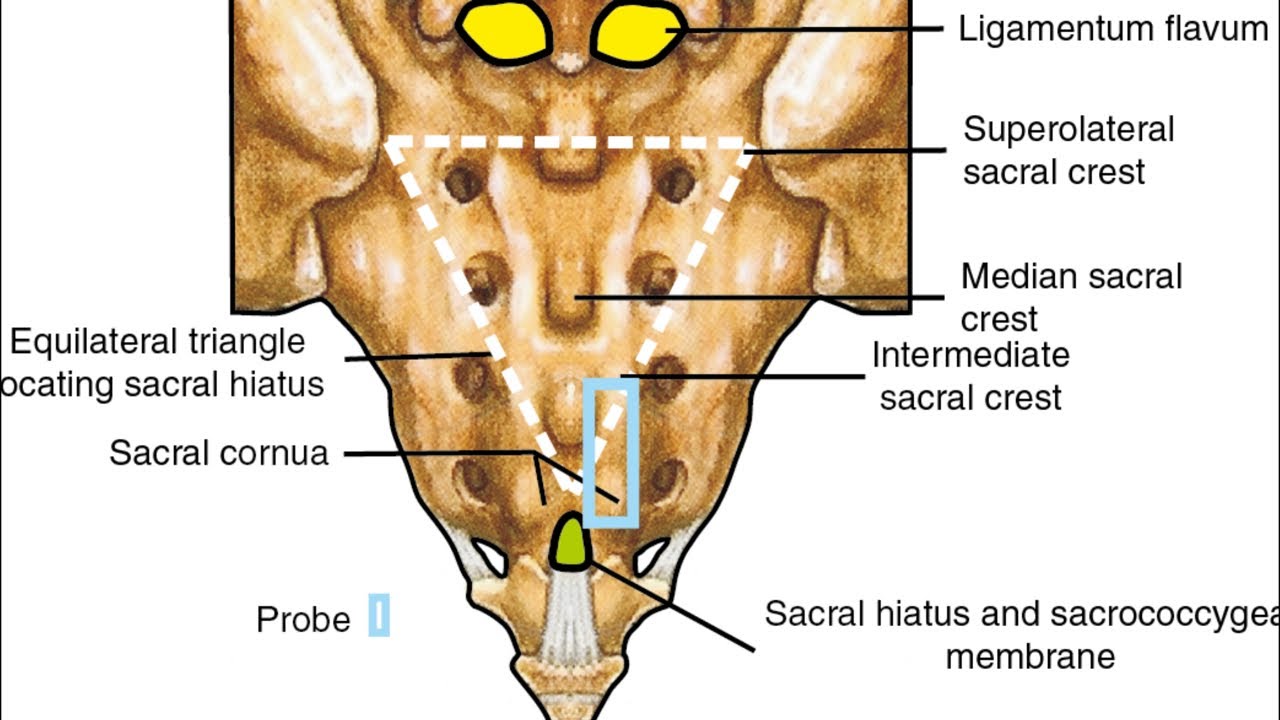 SACRUM BONE-DOORWAY TO THE INVISIBLE TMH WILL USE THE LUZ BONE TO ...