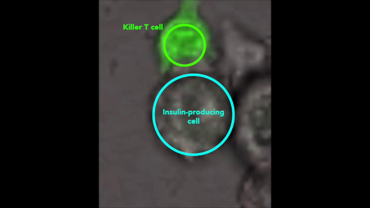 The life (and death) of a pancreatic beta cell - YouTube