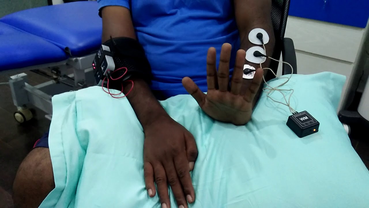 EMG assisted FES training for hand function - YouTube