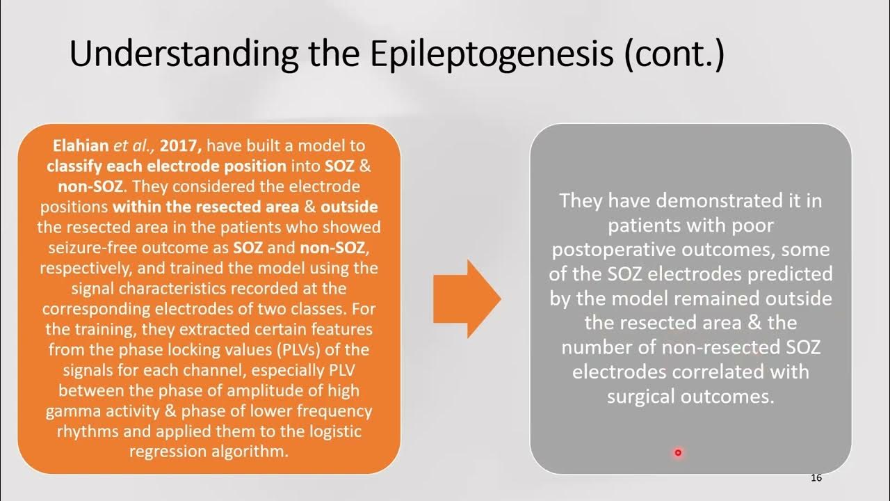 Artificial Intelligence in Epilepsy - YouTube