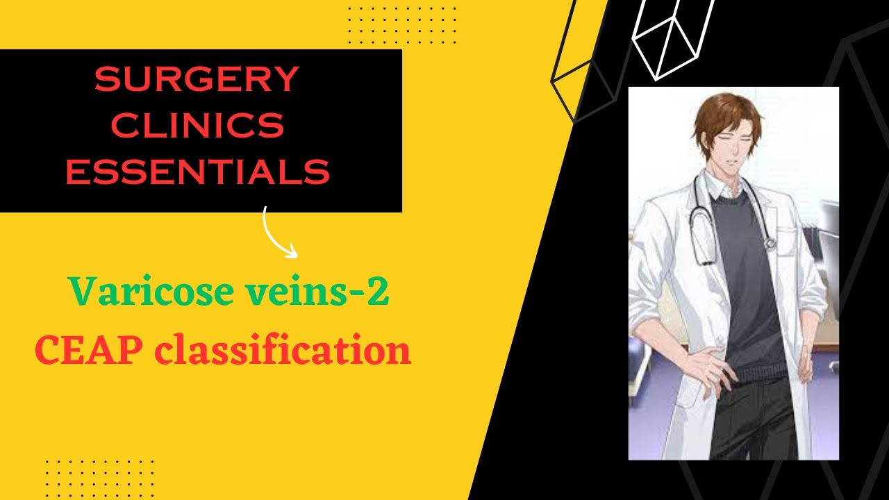 Varicose veins -2|| CEAP classification || surgery clinicals - YouTube