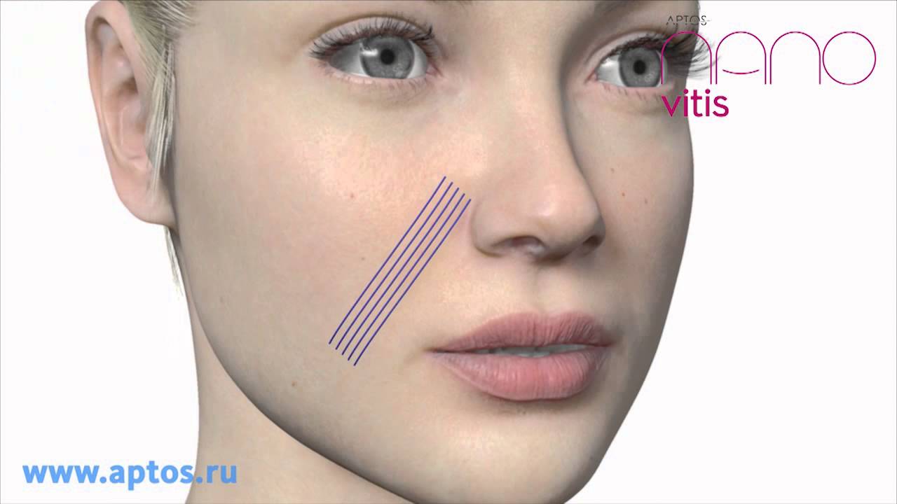 New Aptos Nano Vitis - YouTube