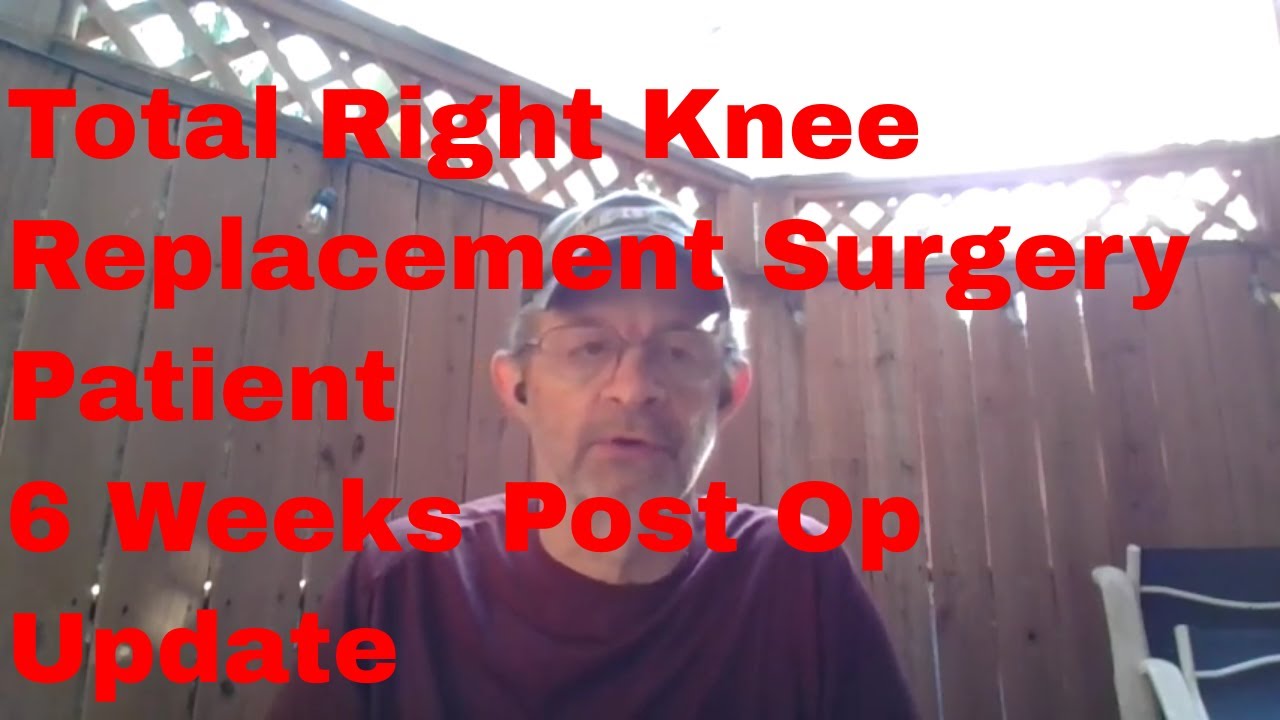 Total Right Knee Replacement Surgery Patient 6 Weeks Post Op Update ...