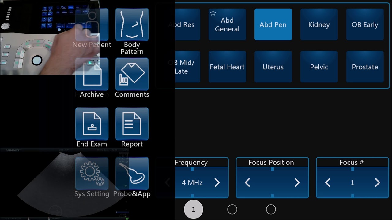 Introduction to VINNO Ultrasound Software: Entering a New Patient - YouTube