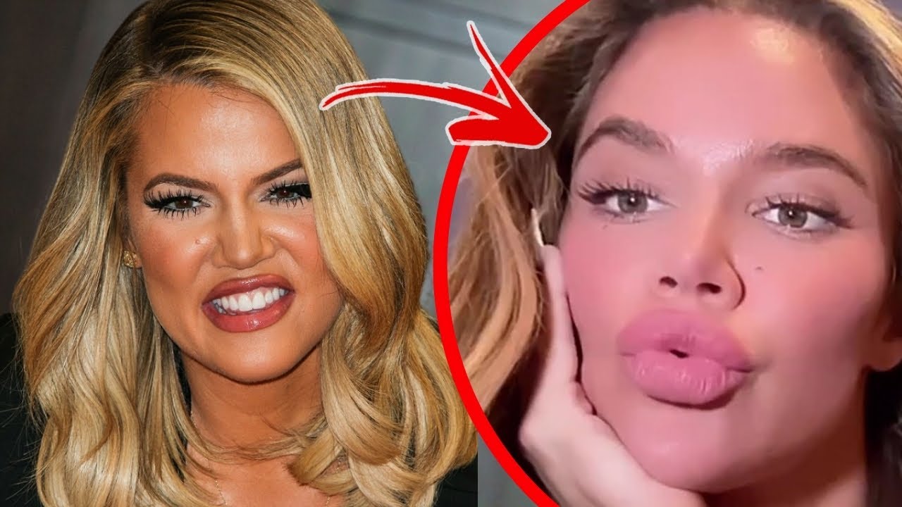 BOTCHED Celebrities That Became Unrecognizable To Fans - YouTube